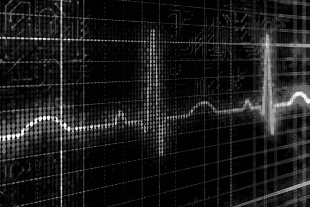Cybersecurity Guidance For Heart Patients With Pacemakers